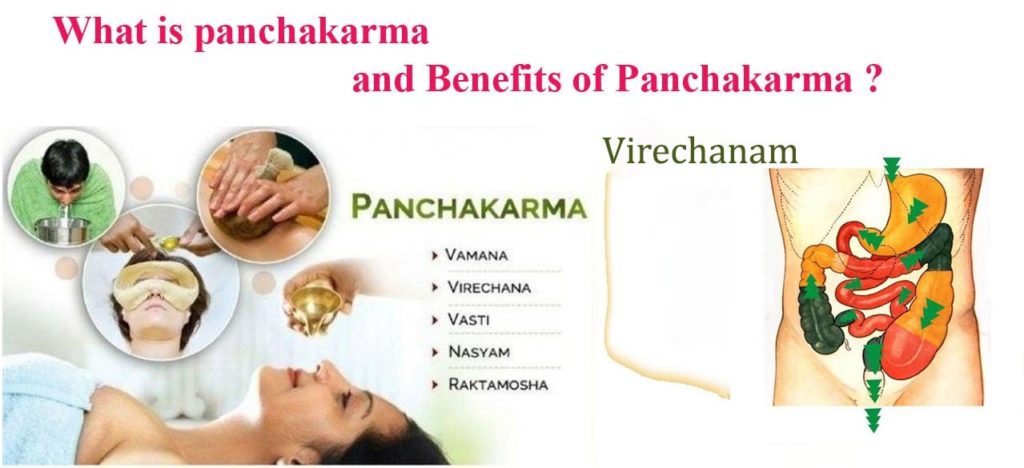 Virechanam Treatment - Dr Chanchal Sharma